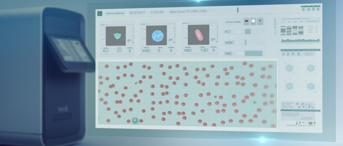 How a portable Israeli blood test device could spur at-home chemo ...