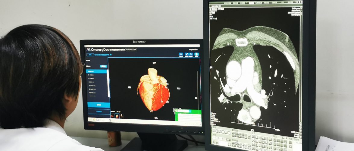 AI to boost doctors’ efficiency with imaging diagnostics: Inside China ...