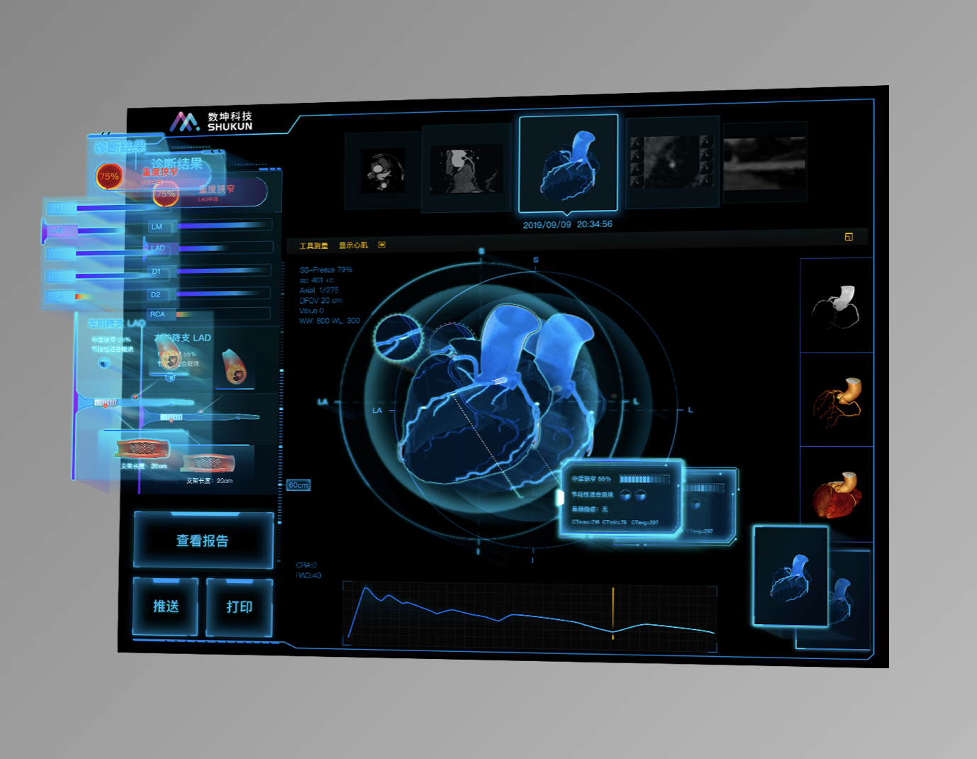 China's Venture Roundup - August 2020