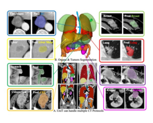 Alibaba’s Damo Academy introduces AI model that can diagnose eight ...